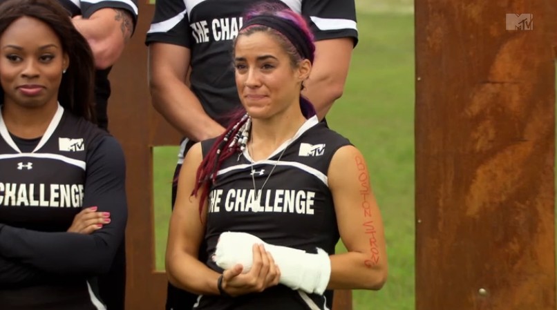 Injuries That Killed Challengers Chances at Victory – Stop Being Polite